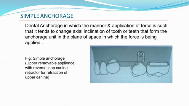 Anchorage in orthodontics | PPTX