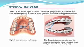 Anchorage in orthodontics | PPTX