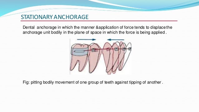 Anchorage in orthodontics
