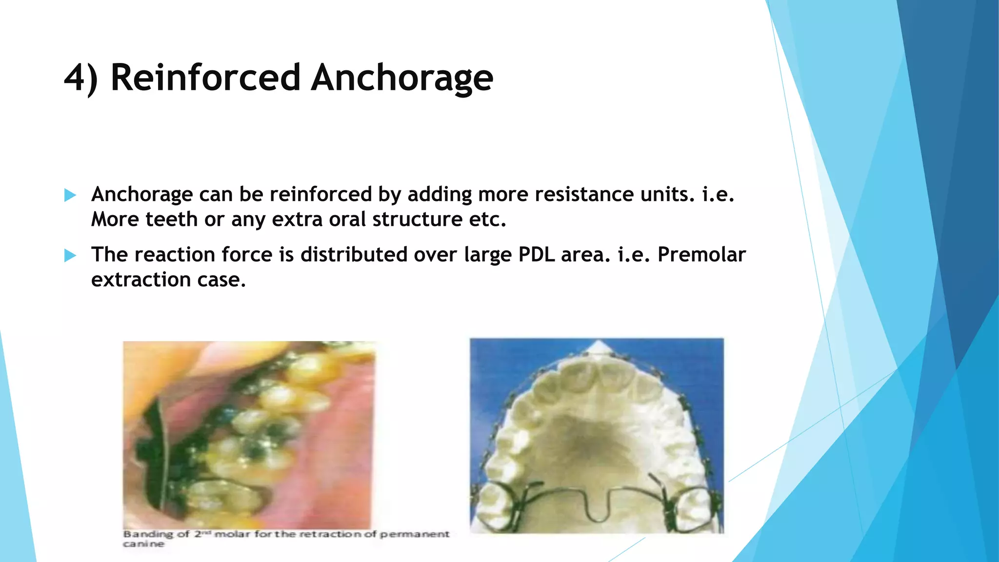 Anchorage in Orthodontics | PPTX