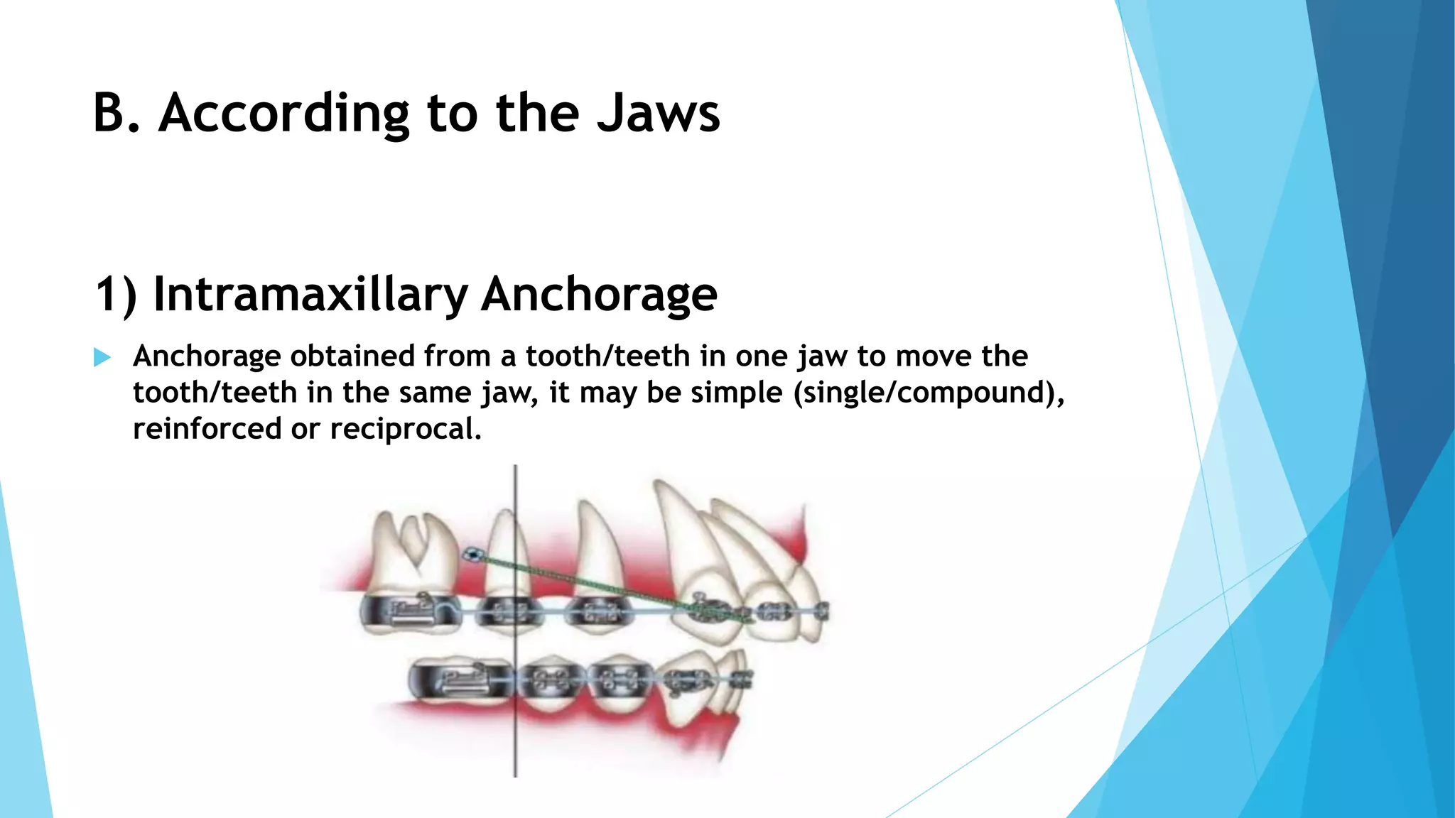 Anchorage in Orthodontics | PPTX