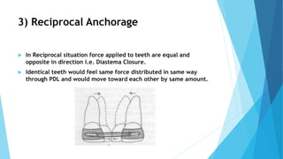 Anchorage in Orthodontics | PPTX