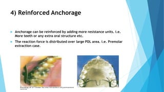 Anchorage in Orthodontics | PPTX