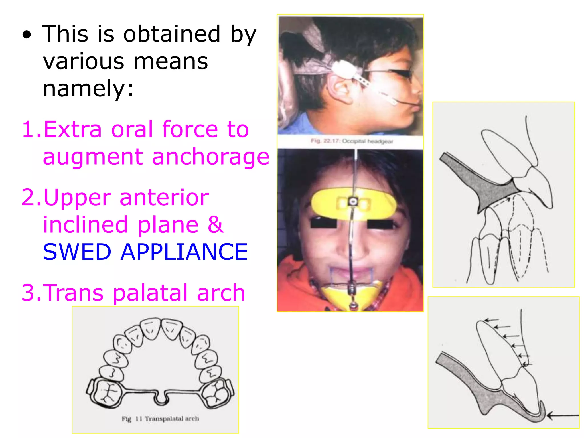 Anchorage in orthodontics | PPT