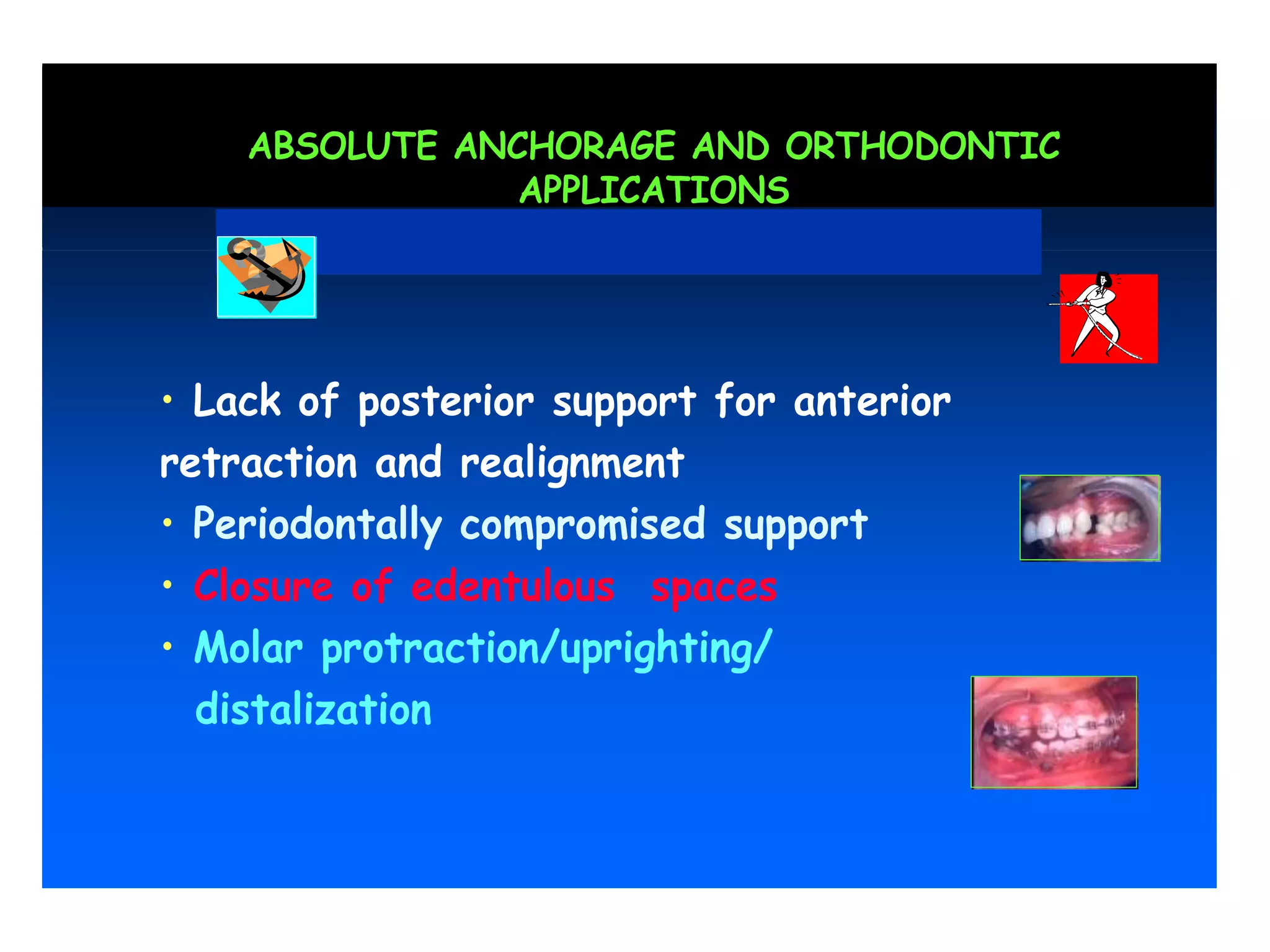 Anchorage in orthodontics | PPT