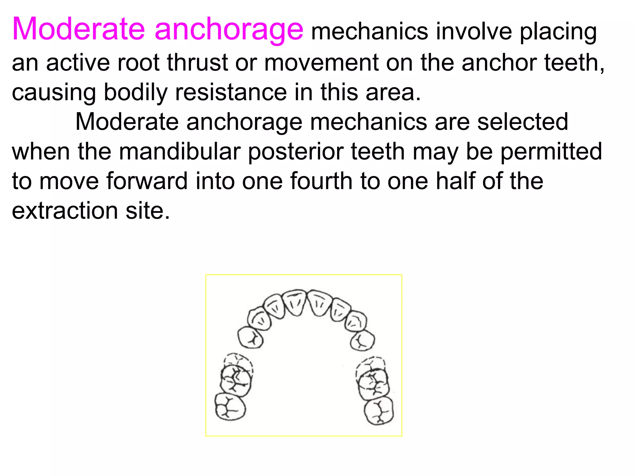 Anchorage in orthodontics | PPT