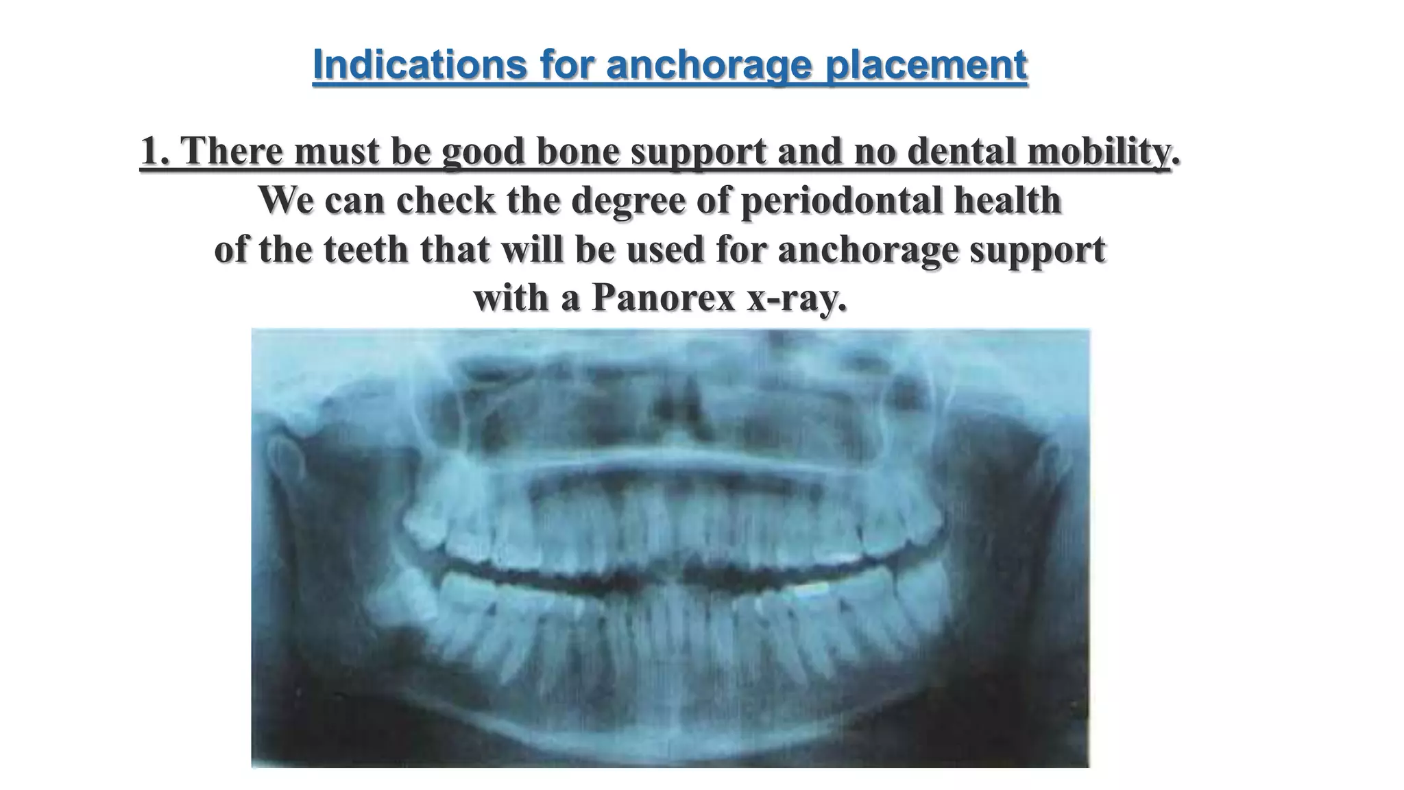 Anchorage in orthodontics | PPTX