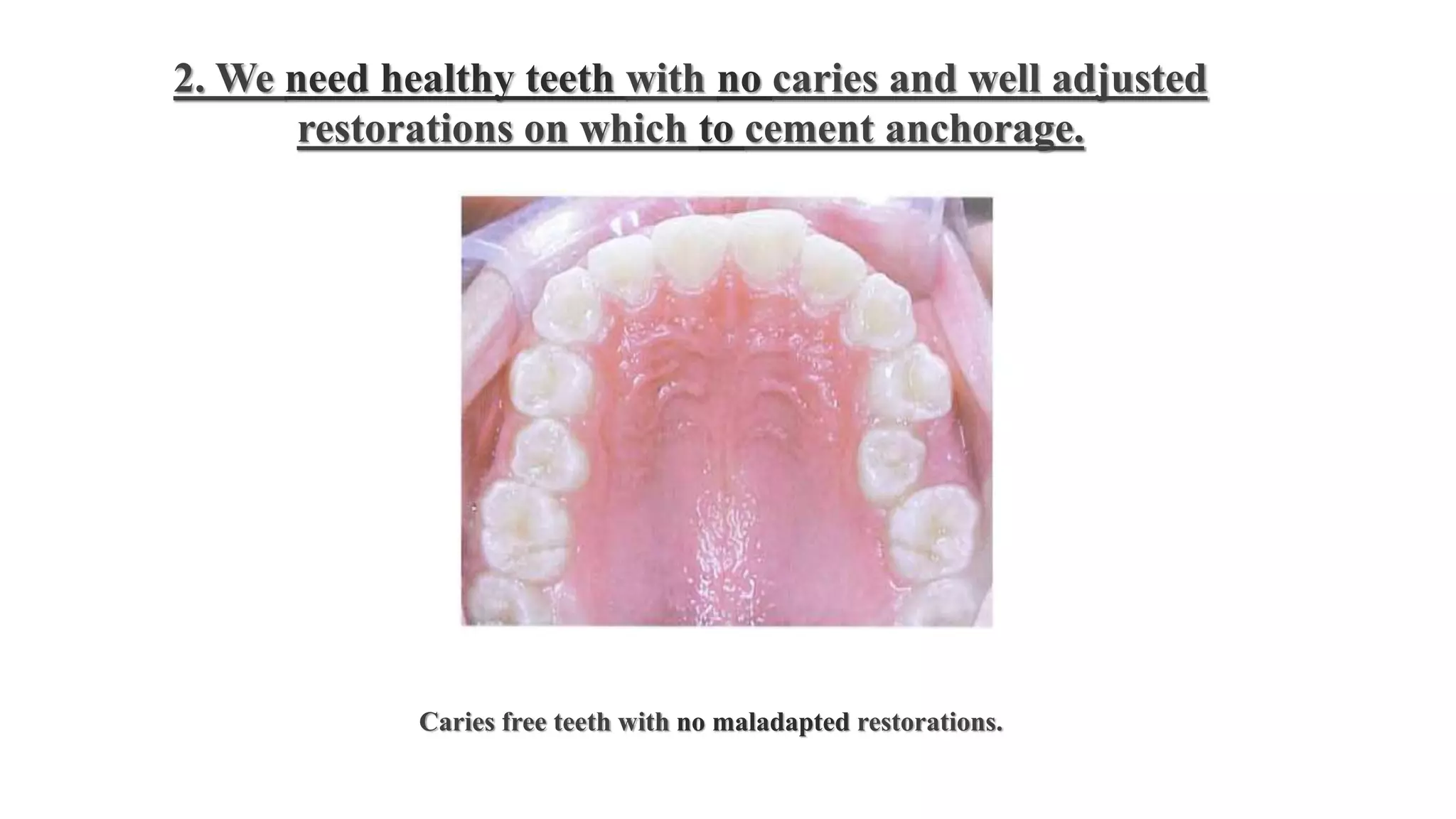 Anchorage in orthodontics | PPTX