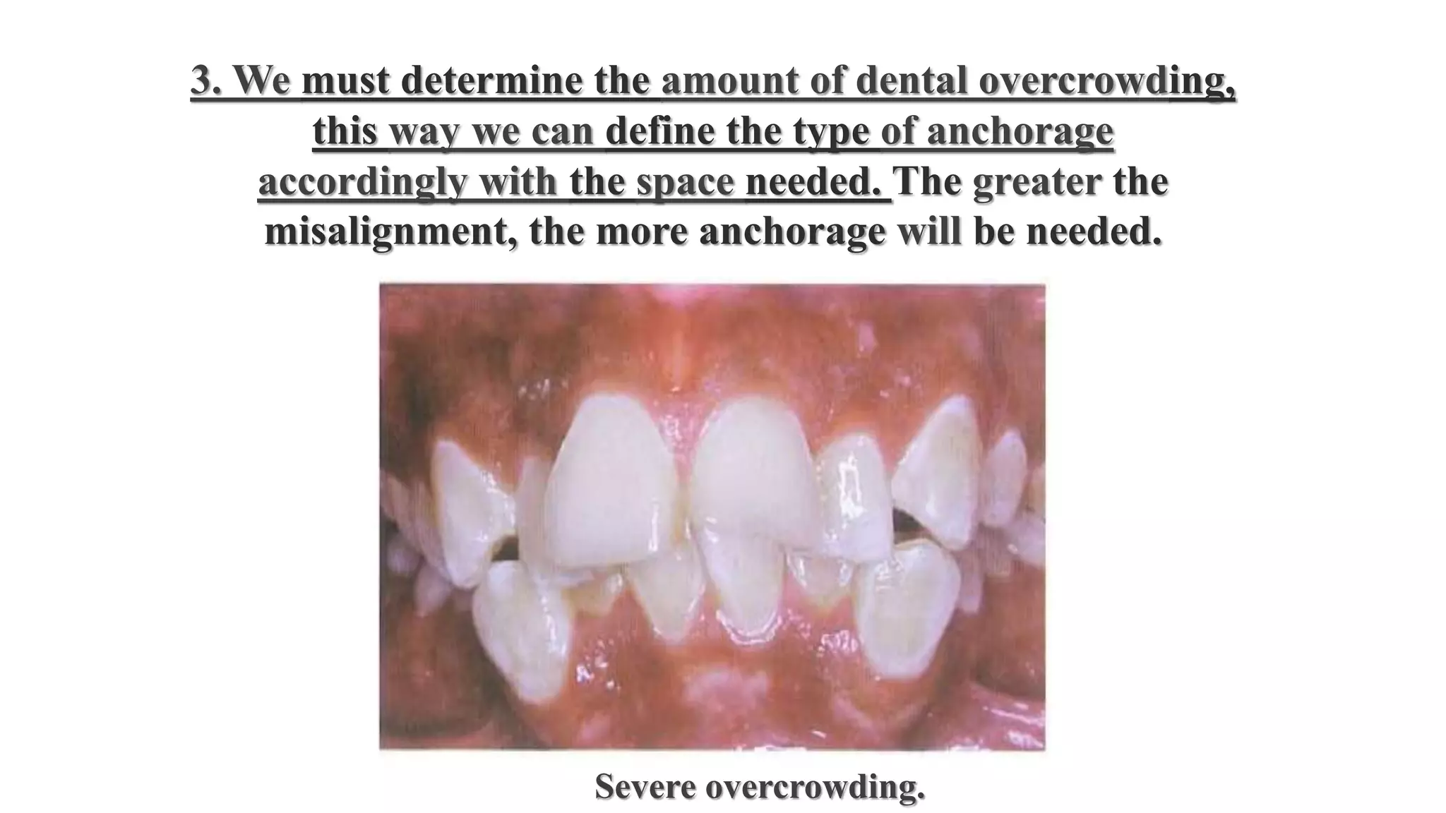 Anchorage in orthodontics | PPTX | Dental Health | Diseases and Conditions