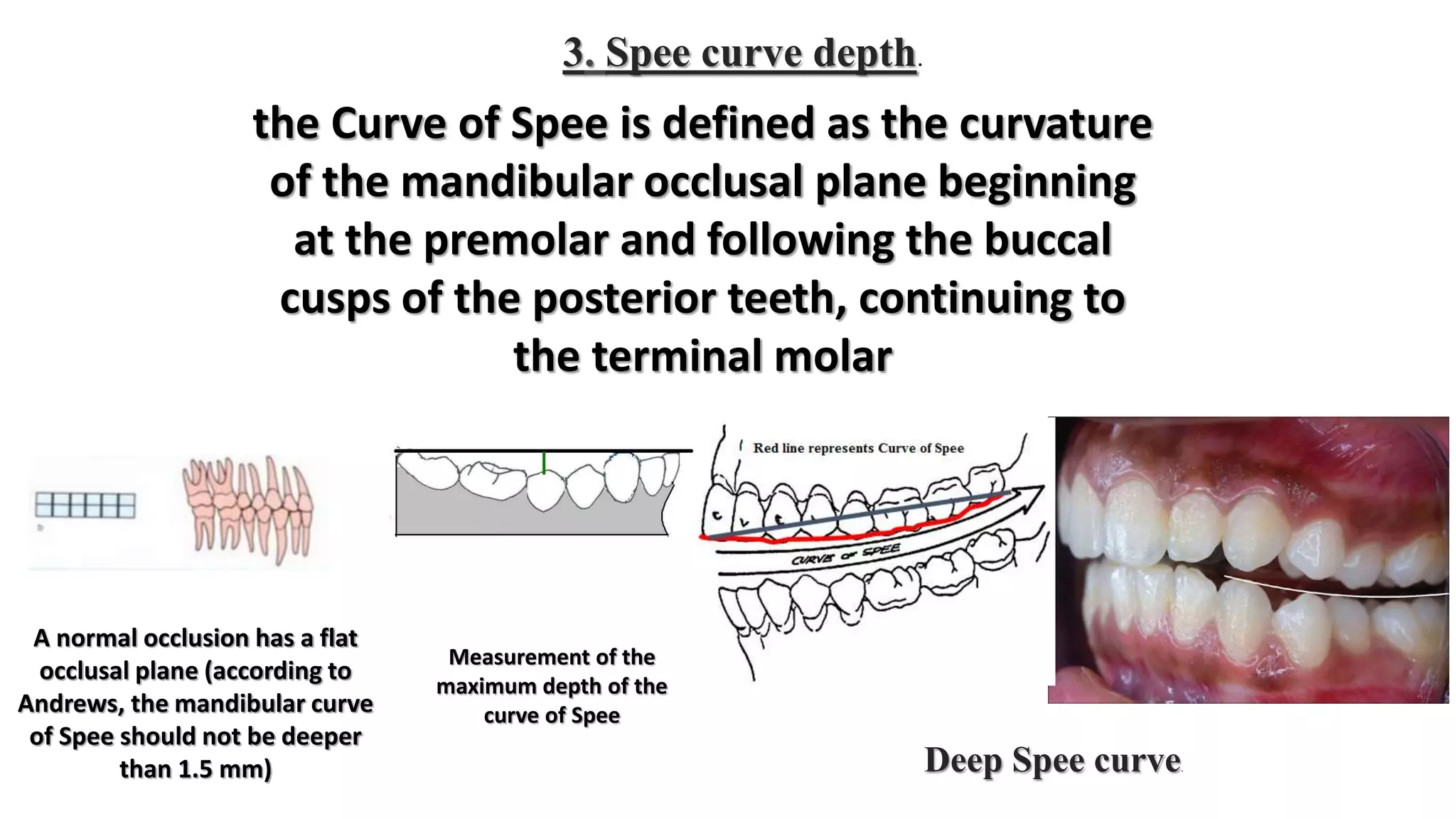 Anchorage in orthodontics | PPTX