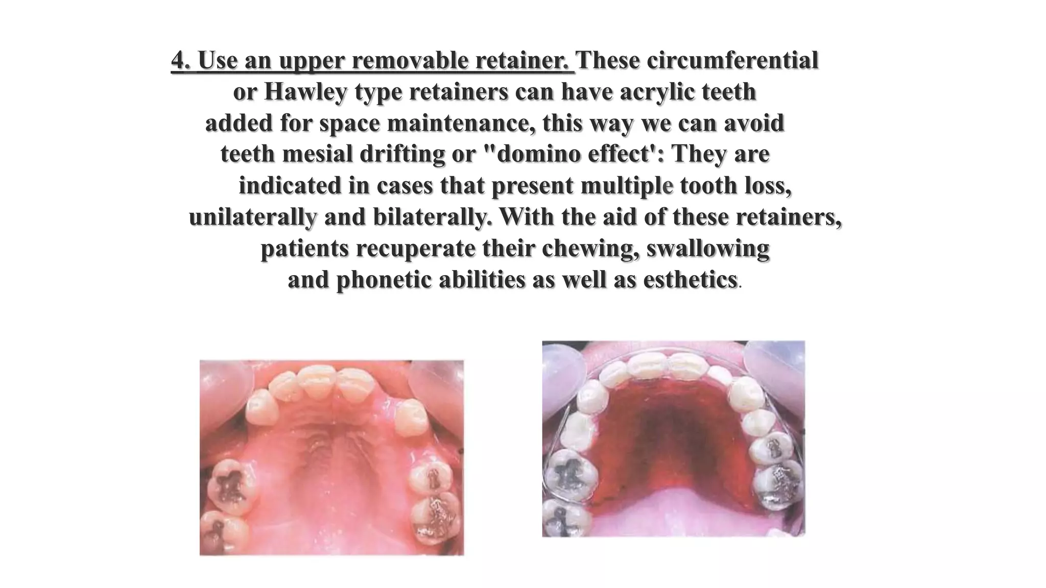 Anchorage in orthodontics | PPTX