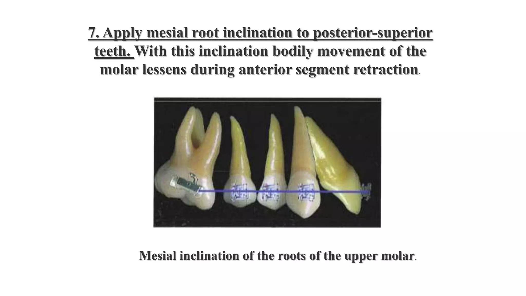 Anchorage in orthodontics | PPTX