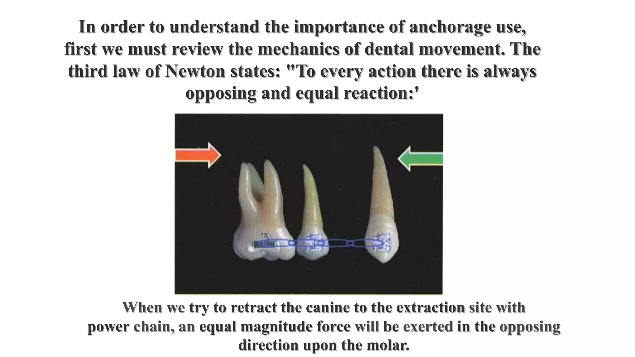 Anchorage in orthodontics | PPTX | Dental Health | Diseases and Conditions