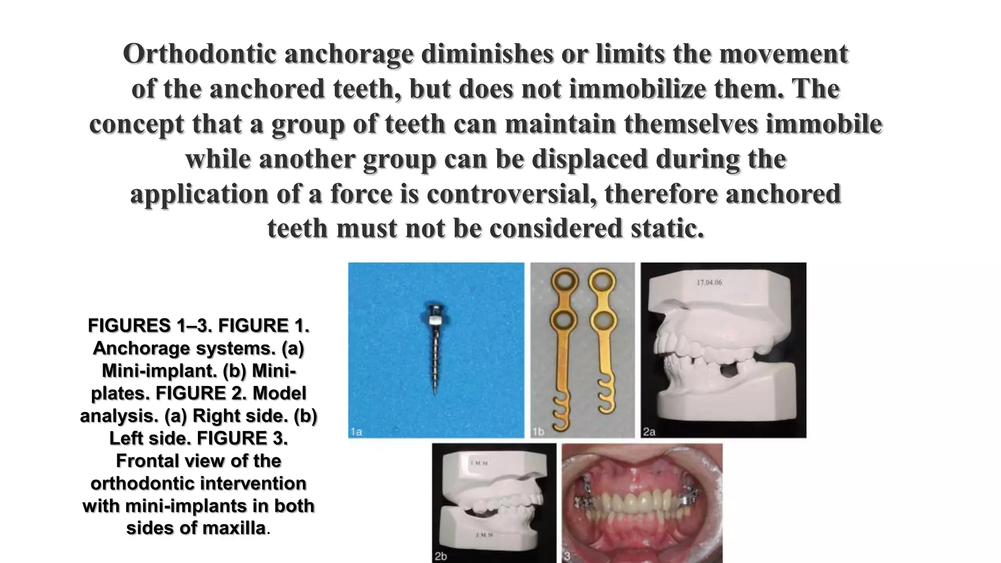 Anchorage in orthodontics | PPTX