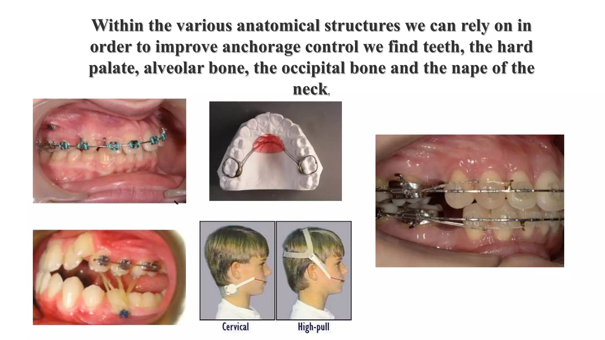 Anchorage in orthodontics | PPTX