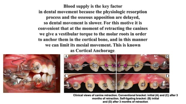 Anchorage in orthodontics | PPTX | Dental Health | Diseases and Conditions
