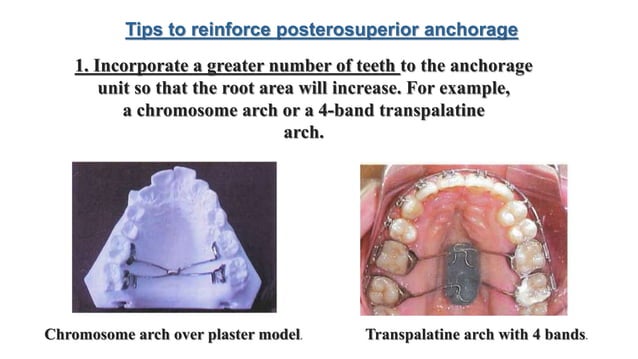 Anchorage in orthodontics | PPTX | Dental Health | Diseases and Conditions