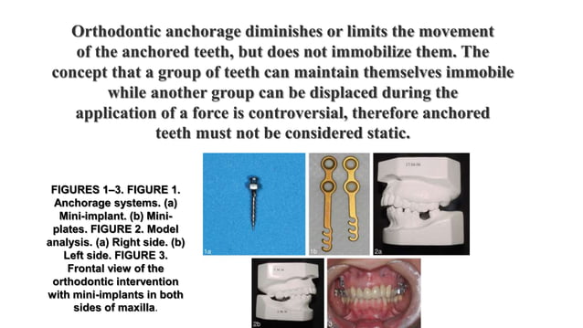 Anchorage in orthodontics | PPTX | Dental Health | Diseases and Conditions