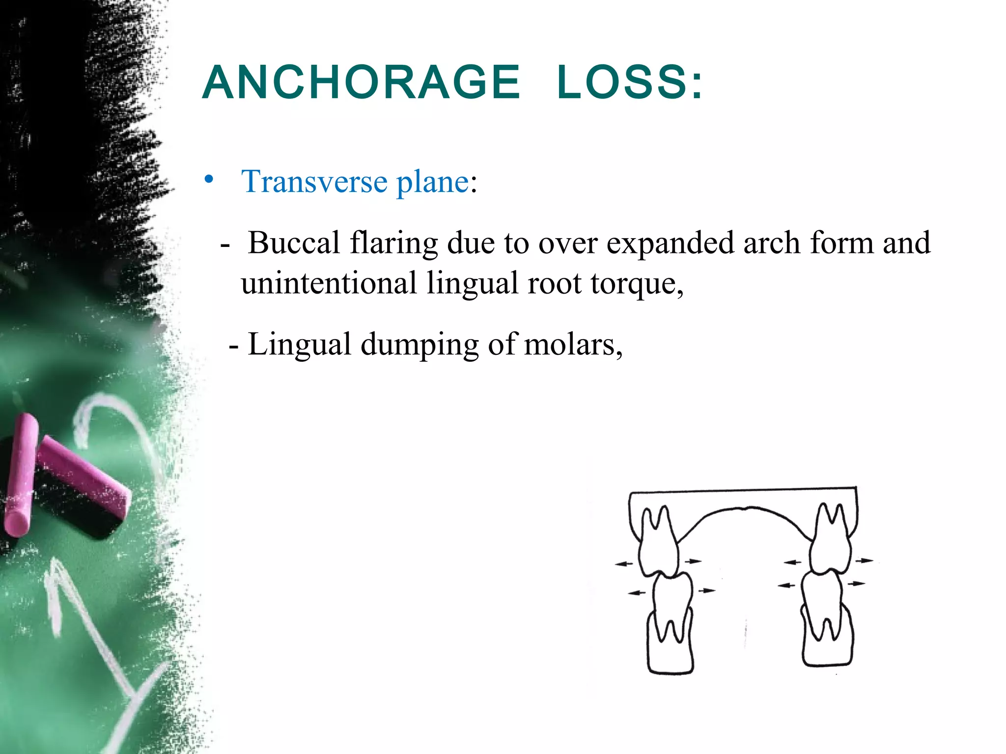 Anchorage in orthodontics | PPT