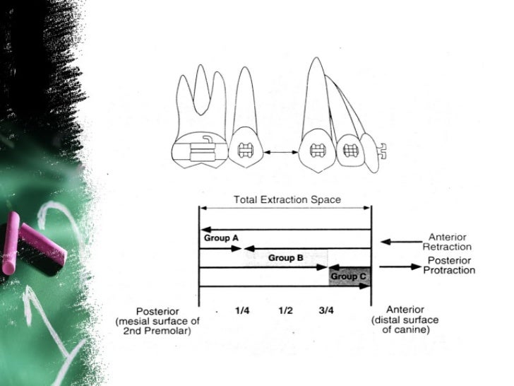 Anchorage in orthodontics