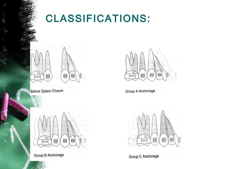 Anchorage in orthodontics