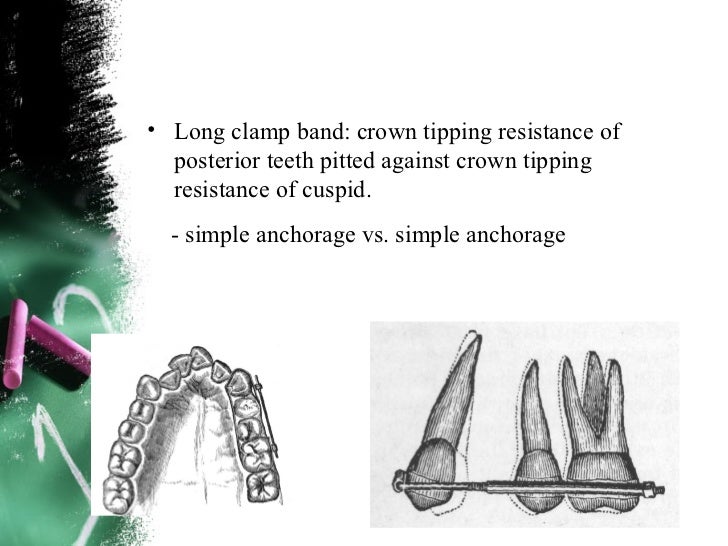 Anchorage in orthodontics