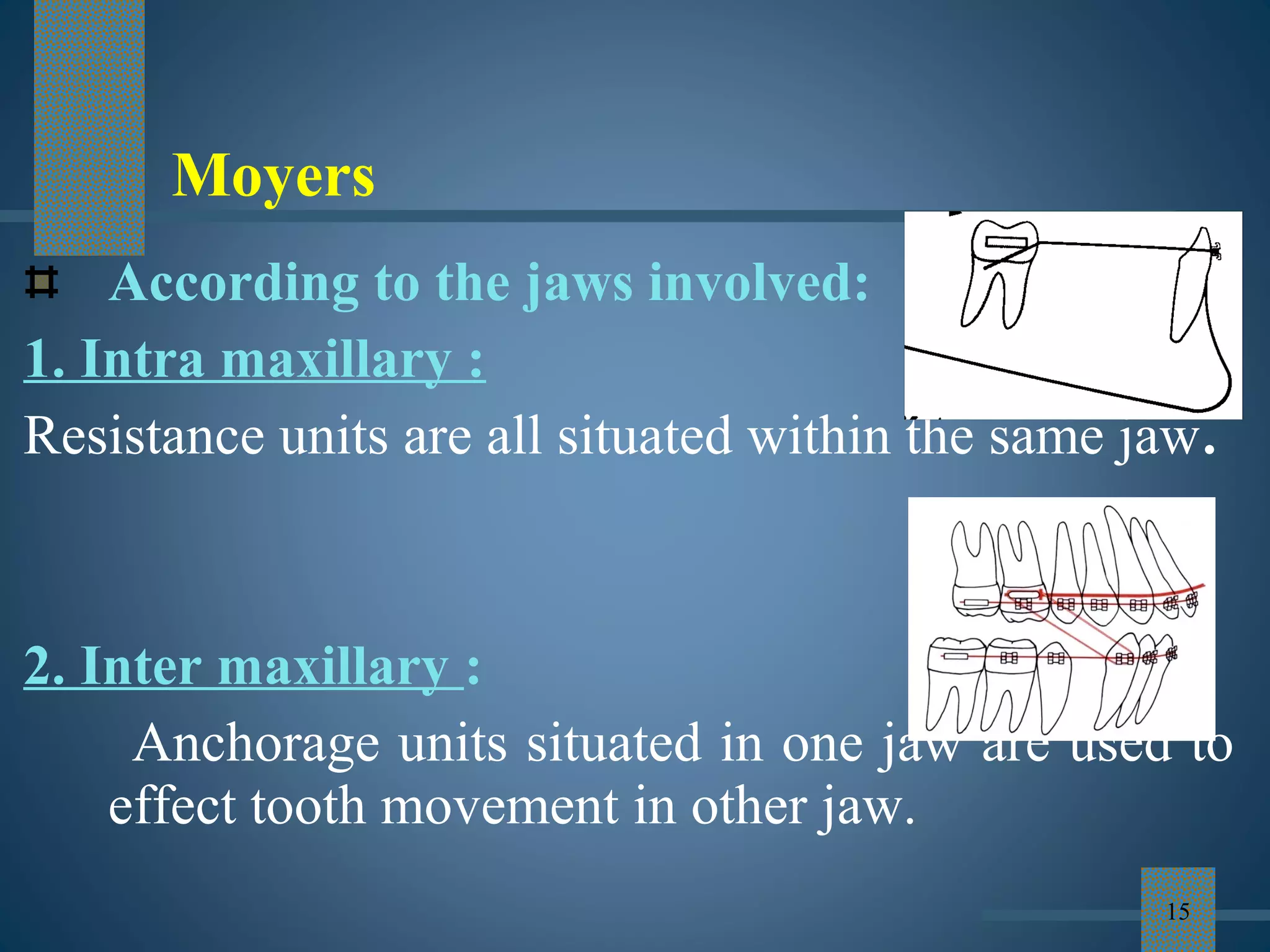 Anchorage in orthodontics ppt | PPT