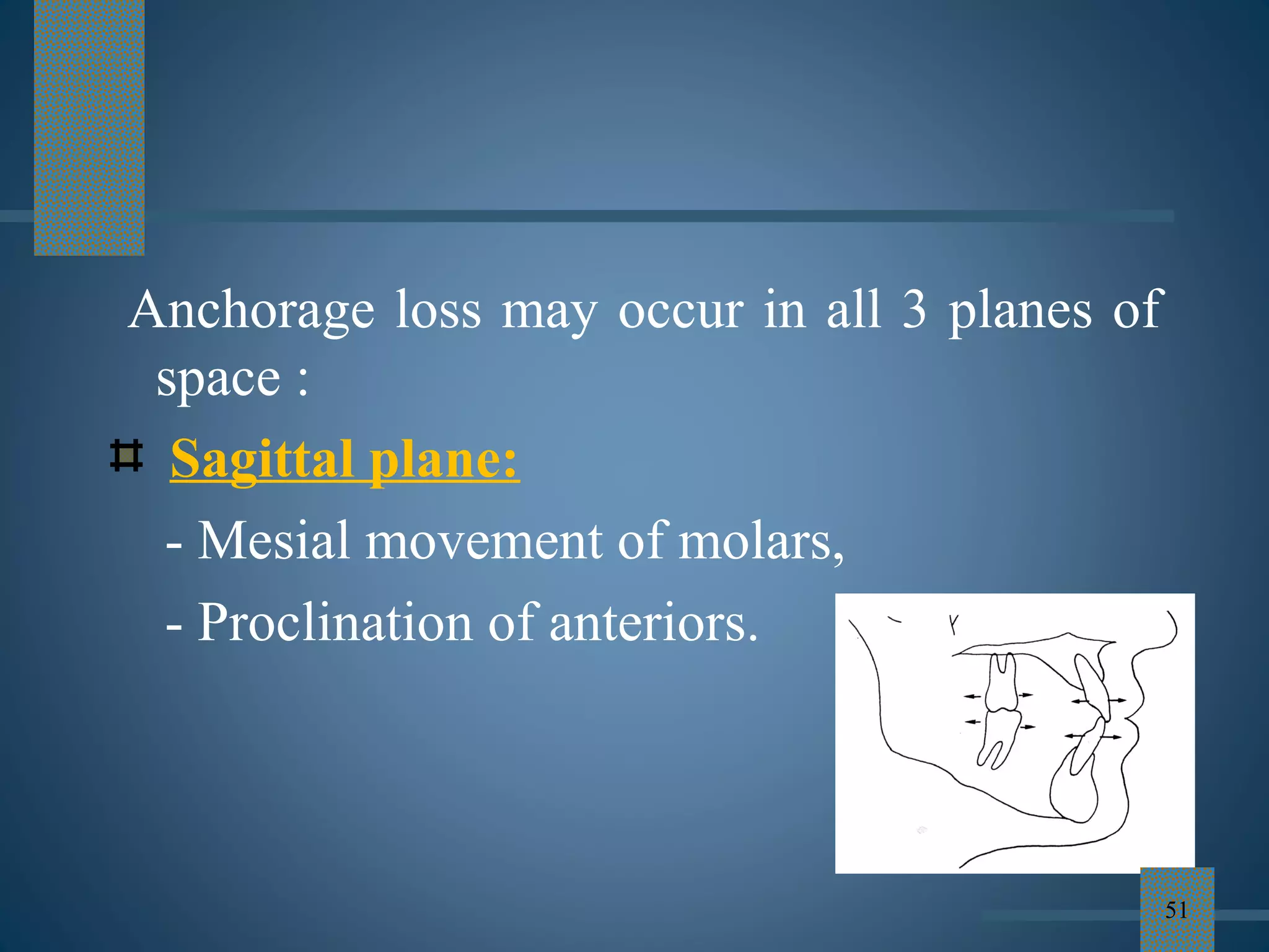 Anchorage in orthodontics ppt | PPT