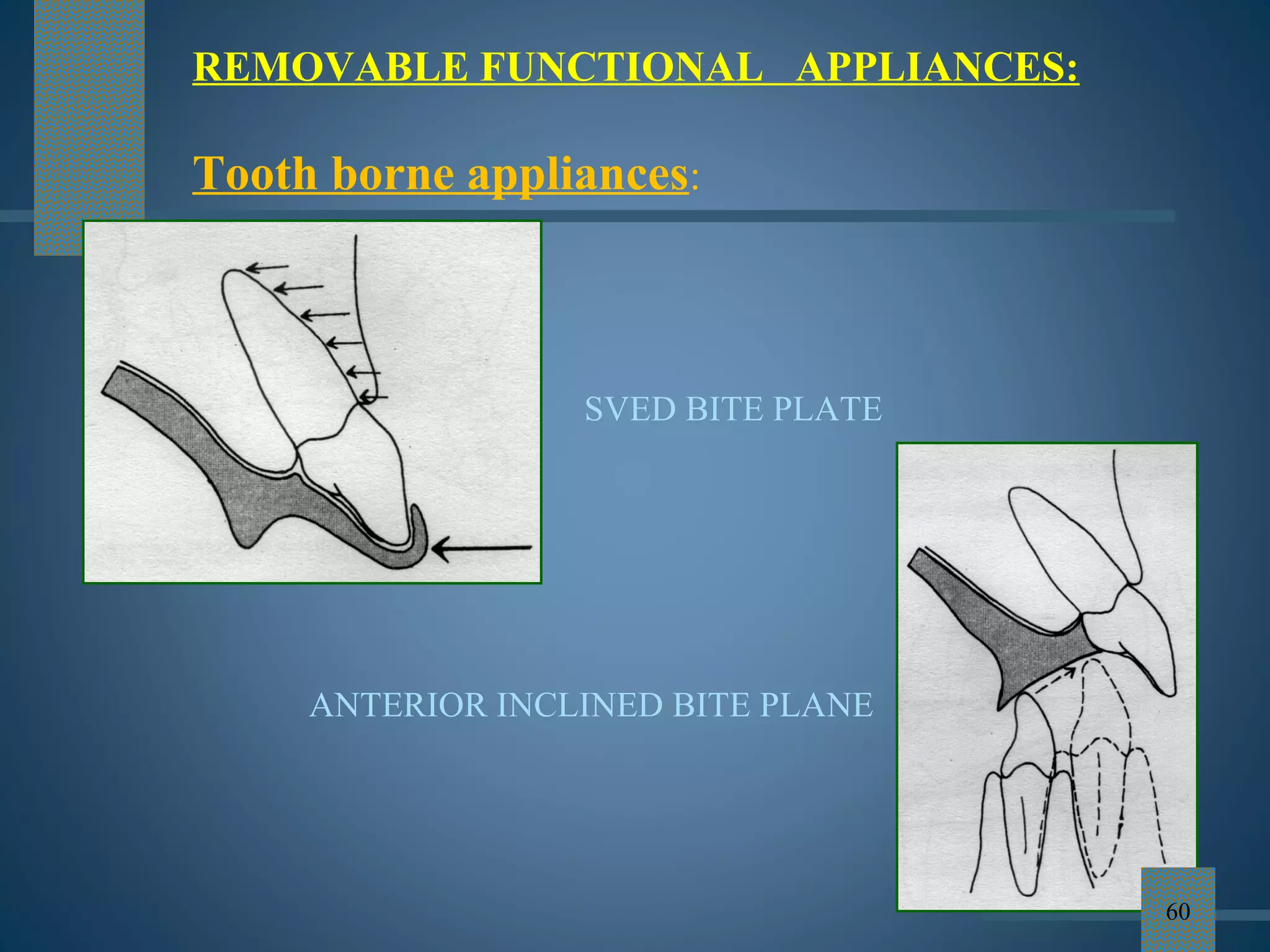 Anchorage in orthodontics ppt | PPT