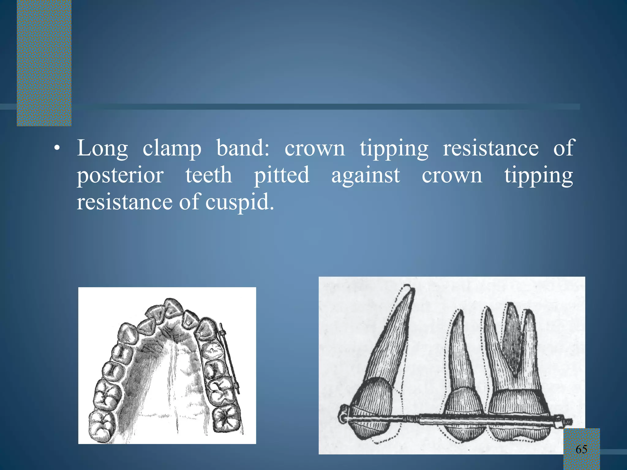 Anchorage in orthodontics ppt | PPT