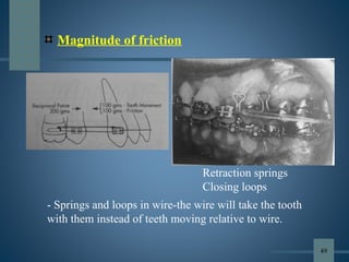 Anchorage in orthodontics ppt | PPT
