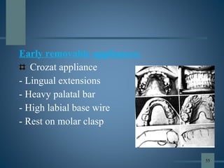 Anchorage in orthodontics ppt | PPT