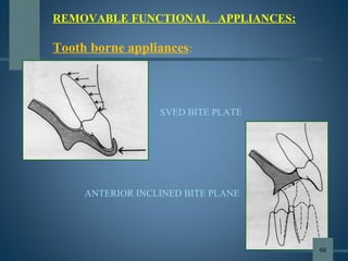 Anchorage in orthodontics ppt | PPT