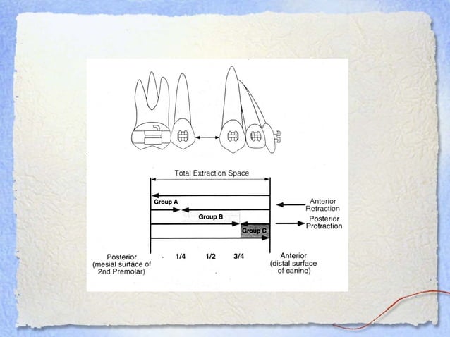 Anchorage in ortodontics tretment cases.pptx