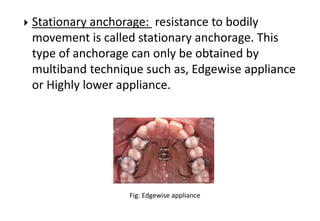 Anchorage & it’s variants | PPTX