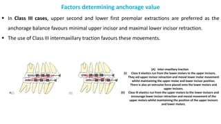 Anchorage management.pdf