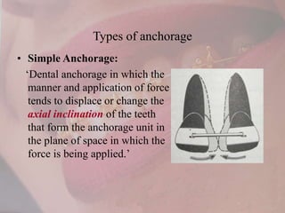 Anchorage O.ppt