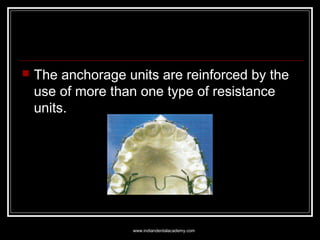 Anchorage ortho | PPT