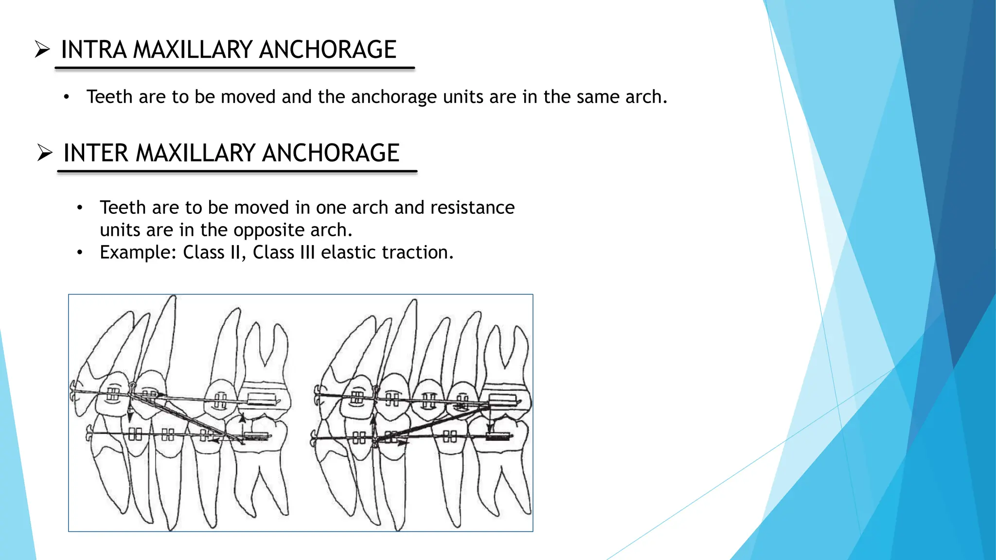 Anchorage presentation Sakshi Dubey.pptx
