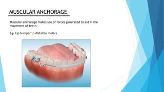 Anchorage presentation Sakshi Dubey.pptx