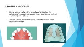 Anchorage presentation Sakshi Dubey.pptx