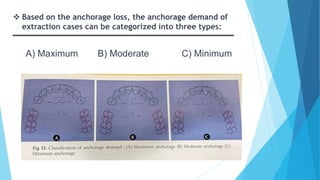 Anchorage presentation Sakshi Dubey.pptx