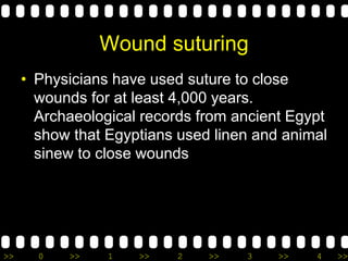 Surgery and medicine In ancient Egypt | PDF