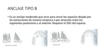 ANCLAJE,CONCEPTO,TIPOS Y MANEJO CLINICO.pptx