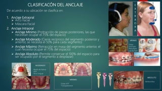 ANCLAJE CORTICAL.pptx