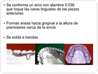 Anclaje en ortodoncia | PPTX