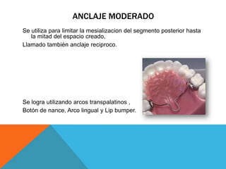 Anclaje y tracción | PPTX