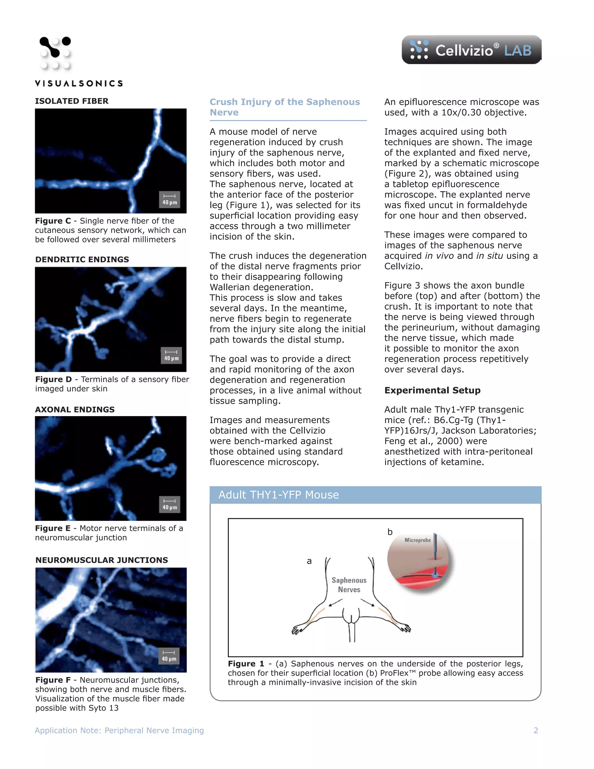 Application Note - Neuroscience: Peripheral Nerve Imaging | PDF