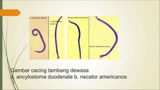 ancylostama duodenale .ppt