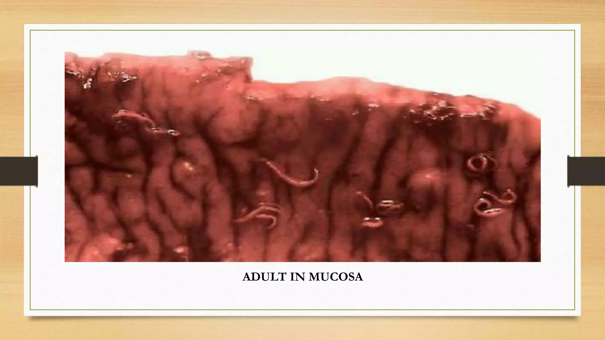 Ancylostoma | PPTX | Infectious Diseases | Diseases and Conditions